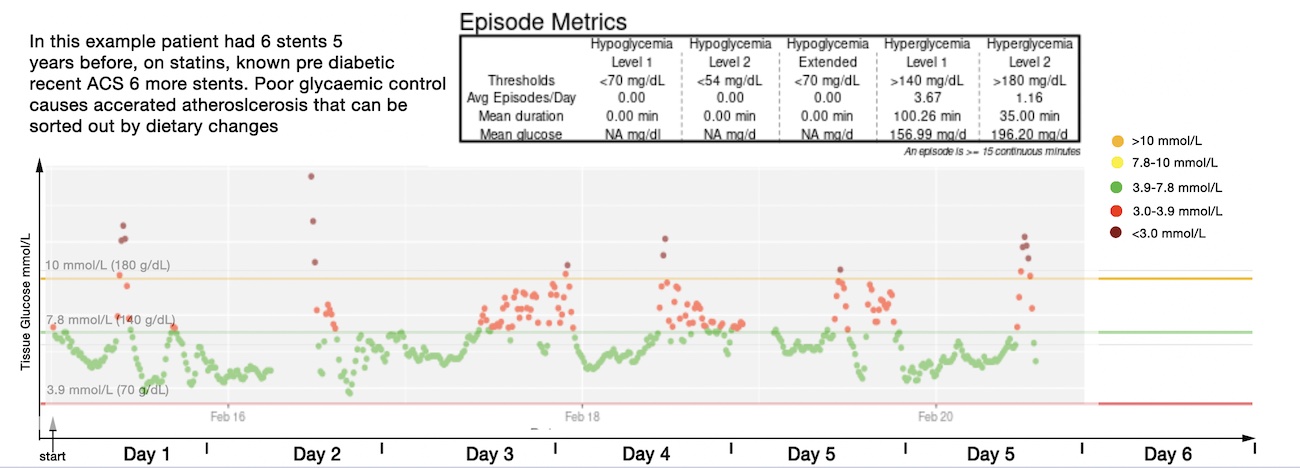 Lets compare continuous glucose monitor (CGM) results | Surrey ...