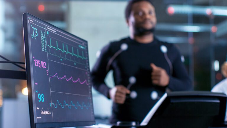 Chronotropic Incompetence | Surrey Cardiovascular Clinic